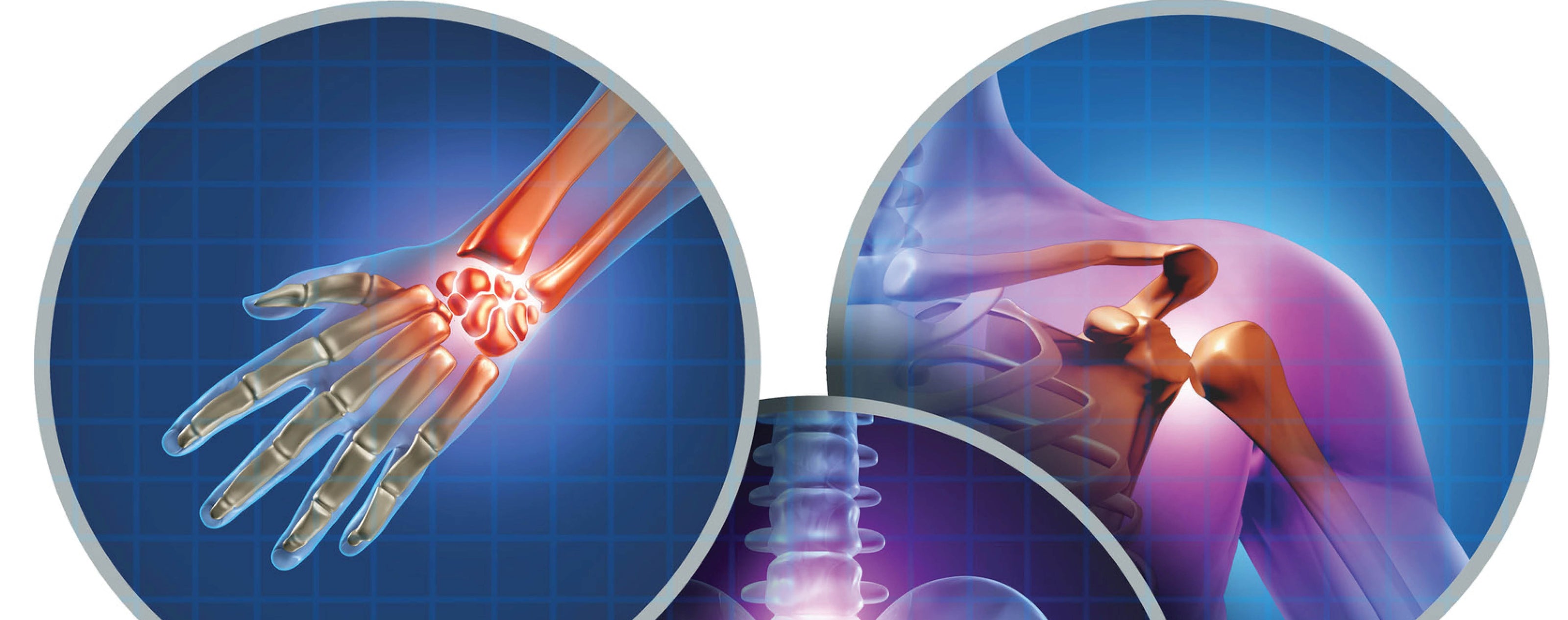 Joint Pain & Inflammation – Bell Lifestyle Products CANADA